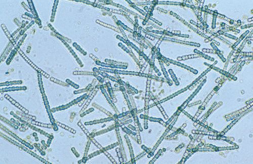 This Summer, Watch Out For Blue-Green Algae In Cleveland